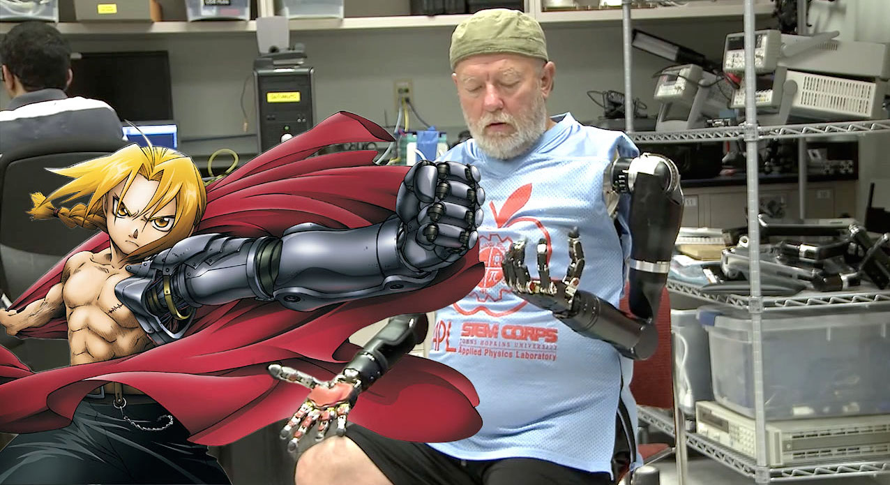 Lee Baugh : Juste le premier homme à avoir deux bras bioniques ...